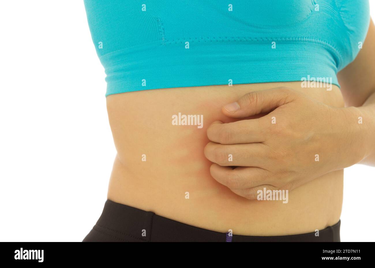 Roy rash red Itching of skin diseases in women using the hand ...