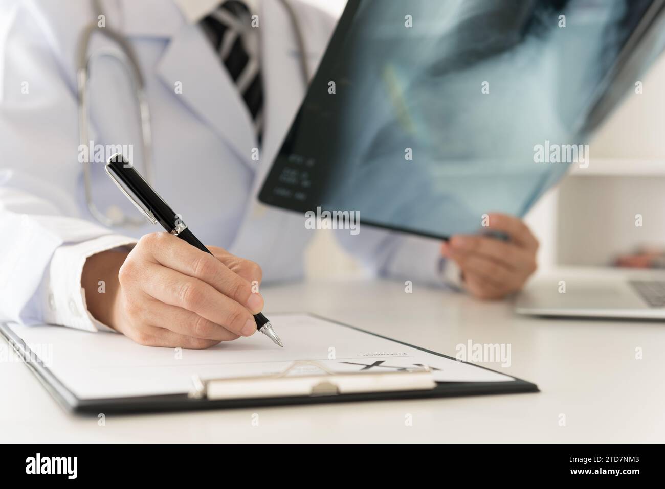 Doctor take notes and examine lung x-ray image. medical and radiology ...