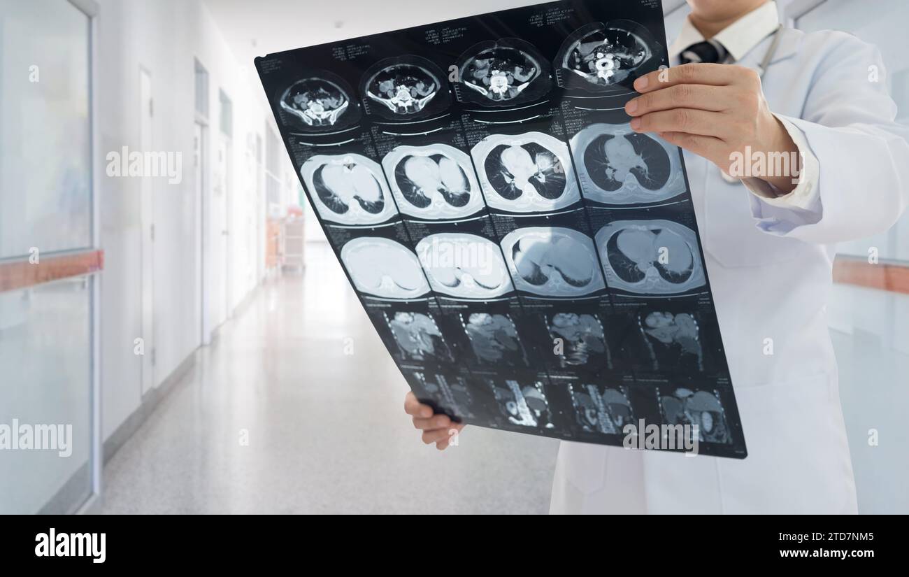 doctor examination x-ray film from mri roentgen at hospital Stock Photo ...