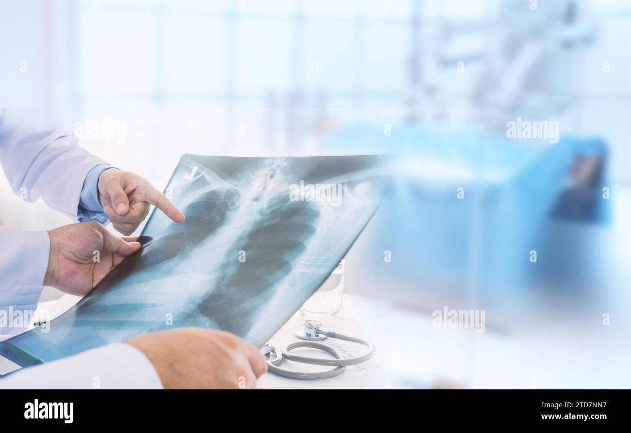 Doctor examining at lungs radiograph x-ray film of patient in operation ...