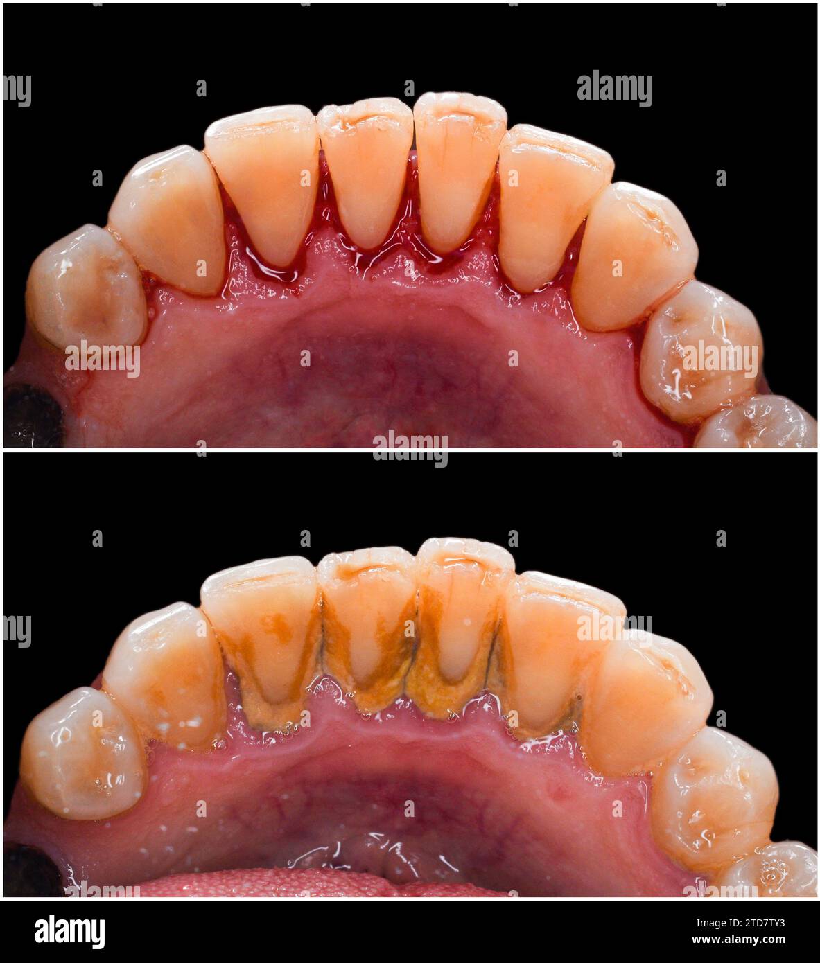 Calculus Cut Out Stock Images & Pictures - Alamy