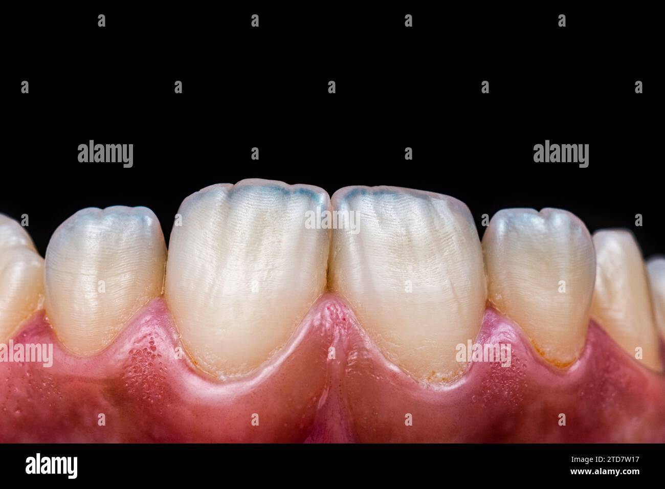 Teeth under hi-res stock photography and images - Alamy