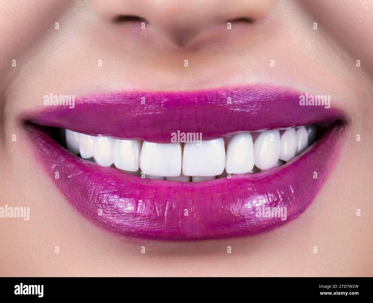 beautiful smile with white Hollywood smile teeth Stock Photo - Alamy
