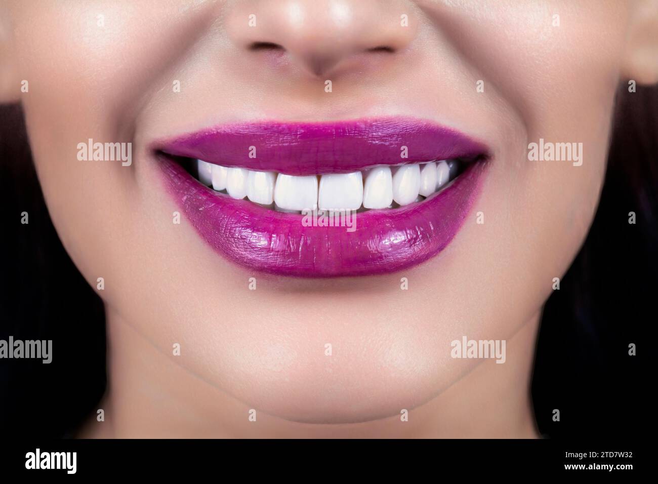 beautiful smile with white Hollywood smile teeth Stock Photo - Alamy
