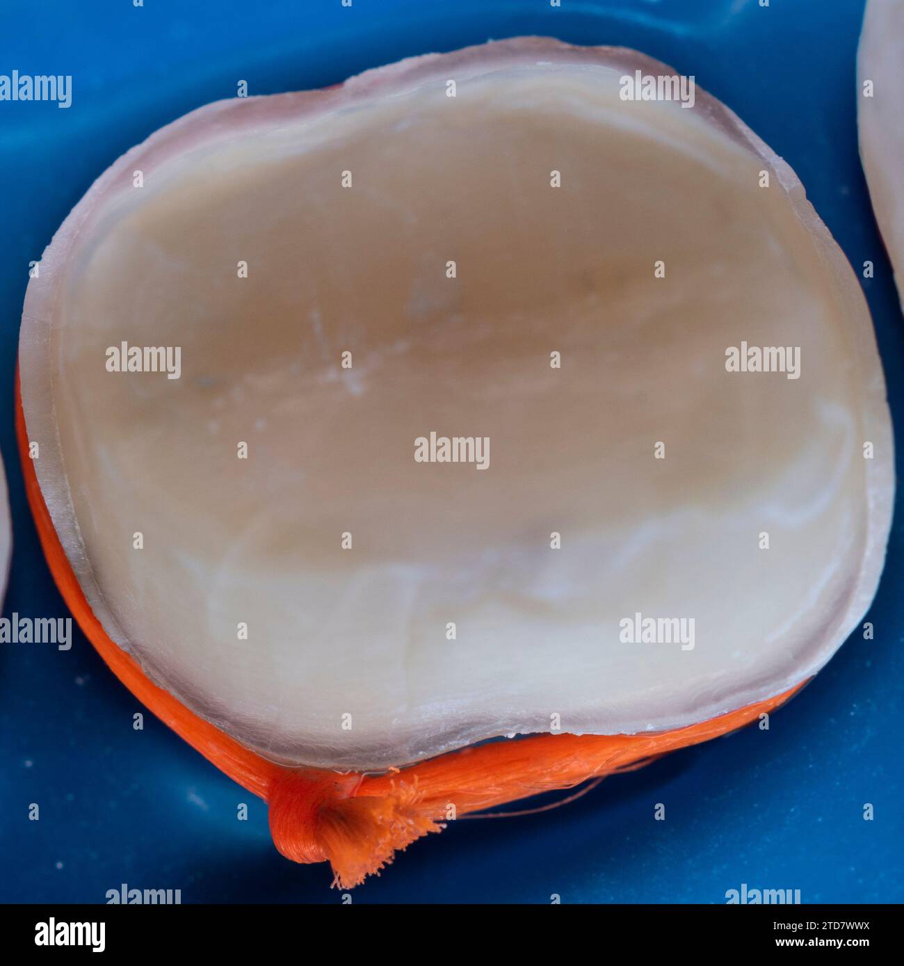 Tooth preparation hi-res stock photography and images - Alamy