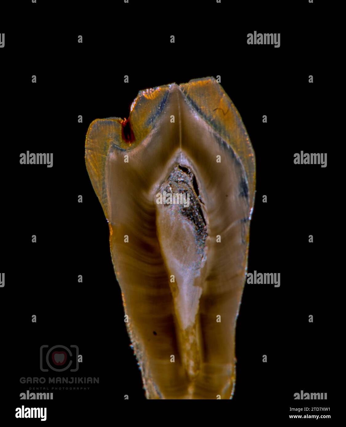 tooth slice macro picture Stock Photo - Alamy