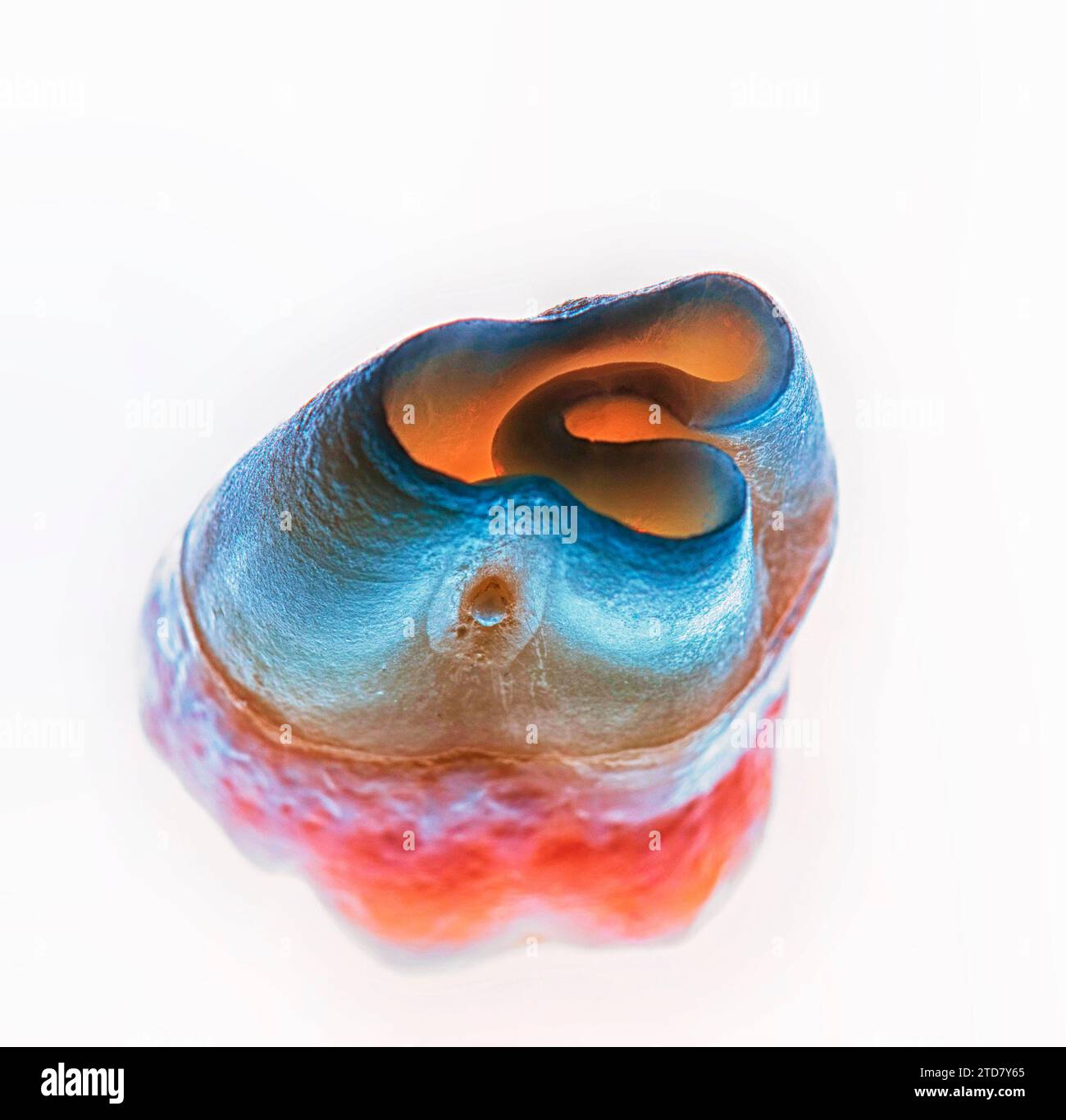 extracted tooth under high magnification Stock Photo - Alamy