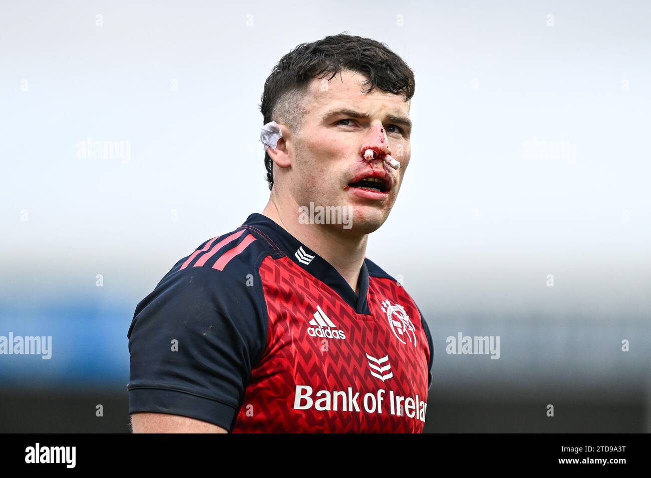 Calvin Nash of Munster with a bloody nose during the Investec Champions ...
