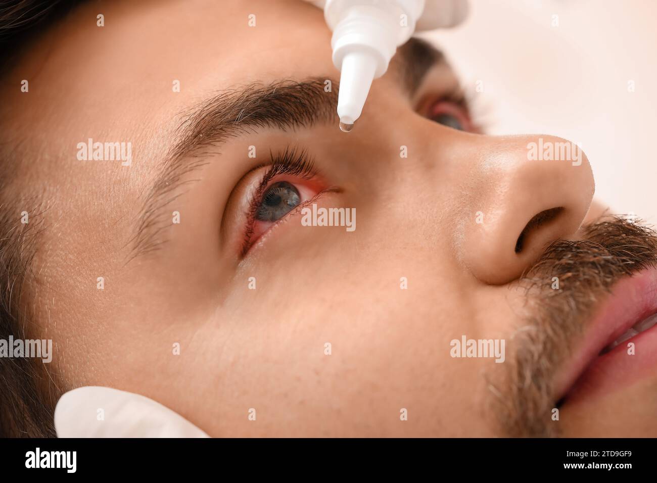 Man putting eye drops in his eyes hi-res stock photography and images ...