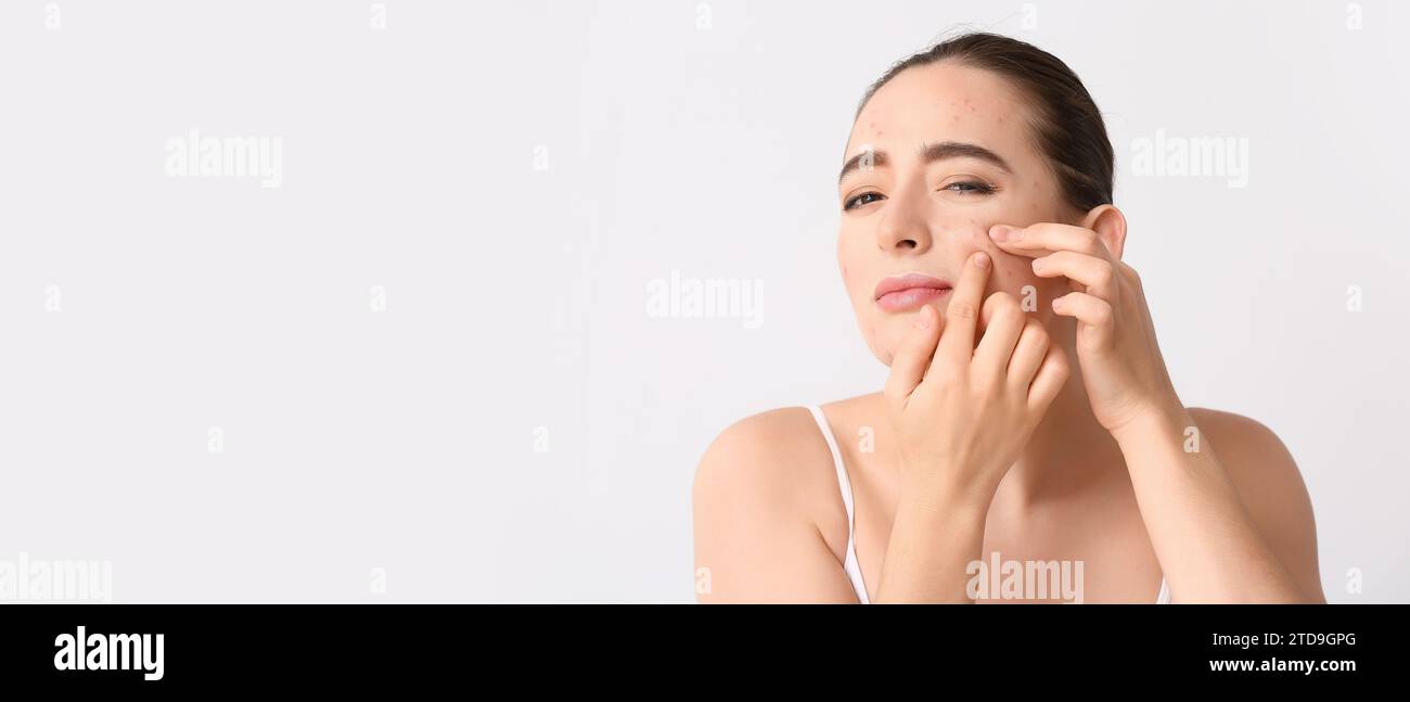 Young woman with acne problem squishing pimples on light background ...