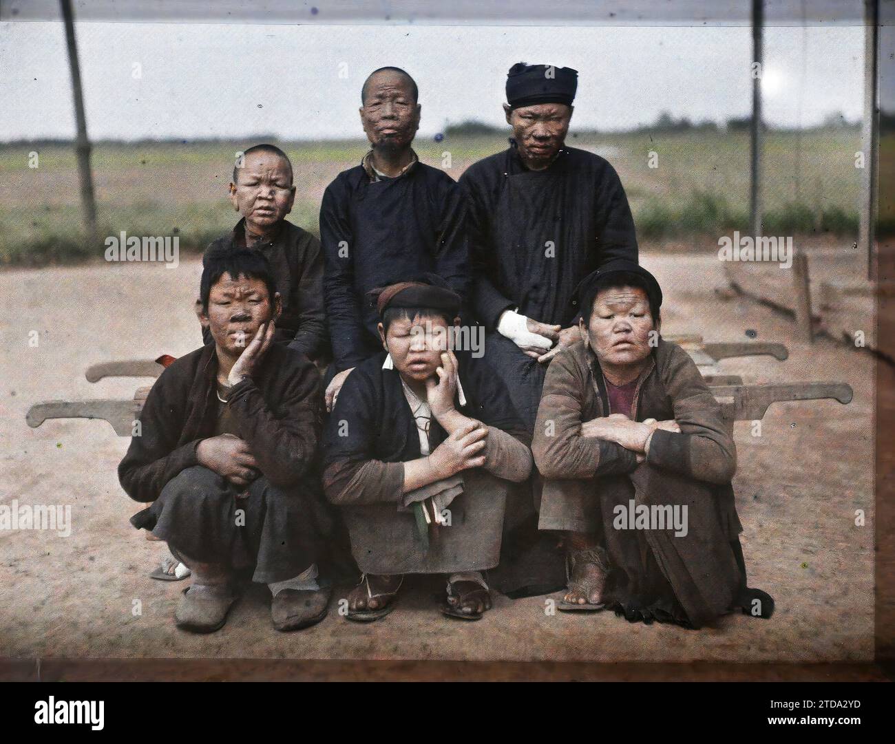 Yên-duyên, Tonkin, Indochina A group of lepers in a leper colony in Du ...