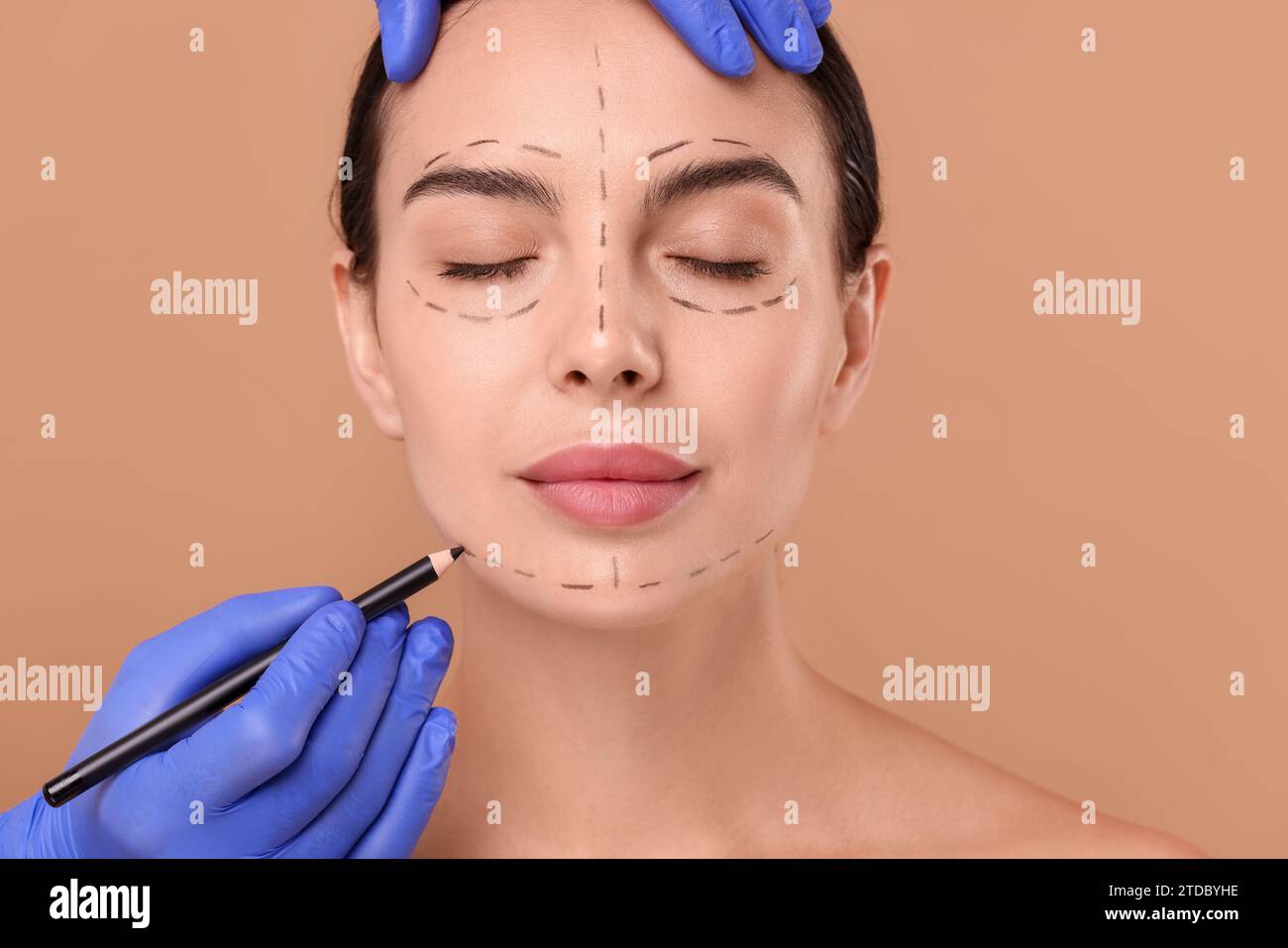 Doctor drawing marks on woman's face for cosmetic surgery operation ...