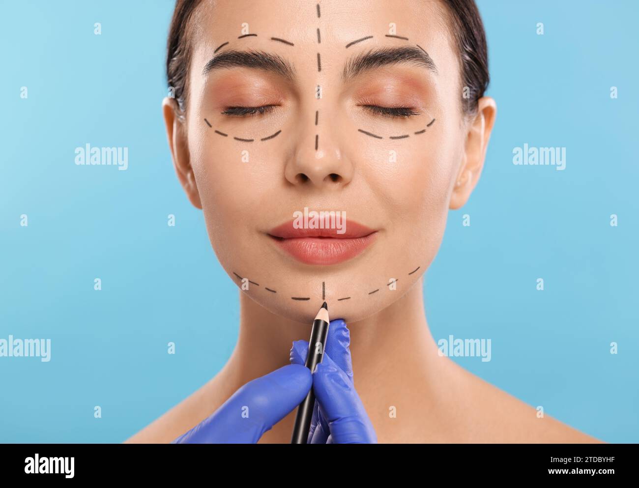 Doctor drawing marks on woman's face for cosmetic surgery operation ...