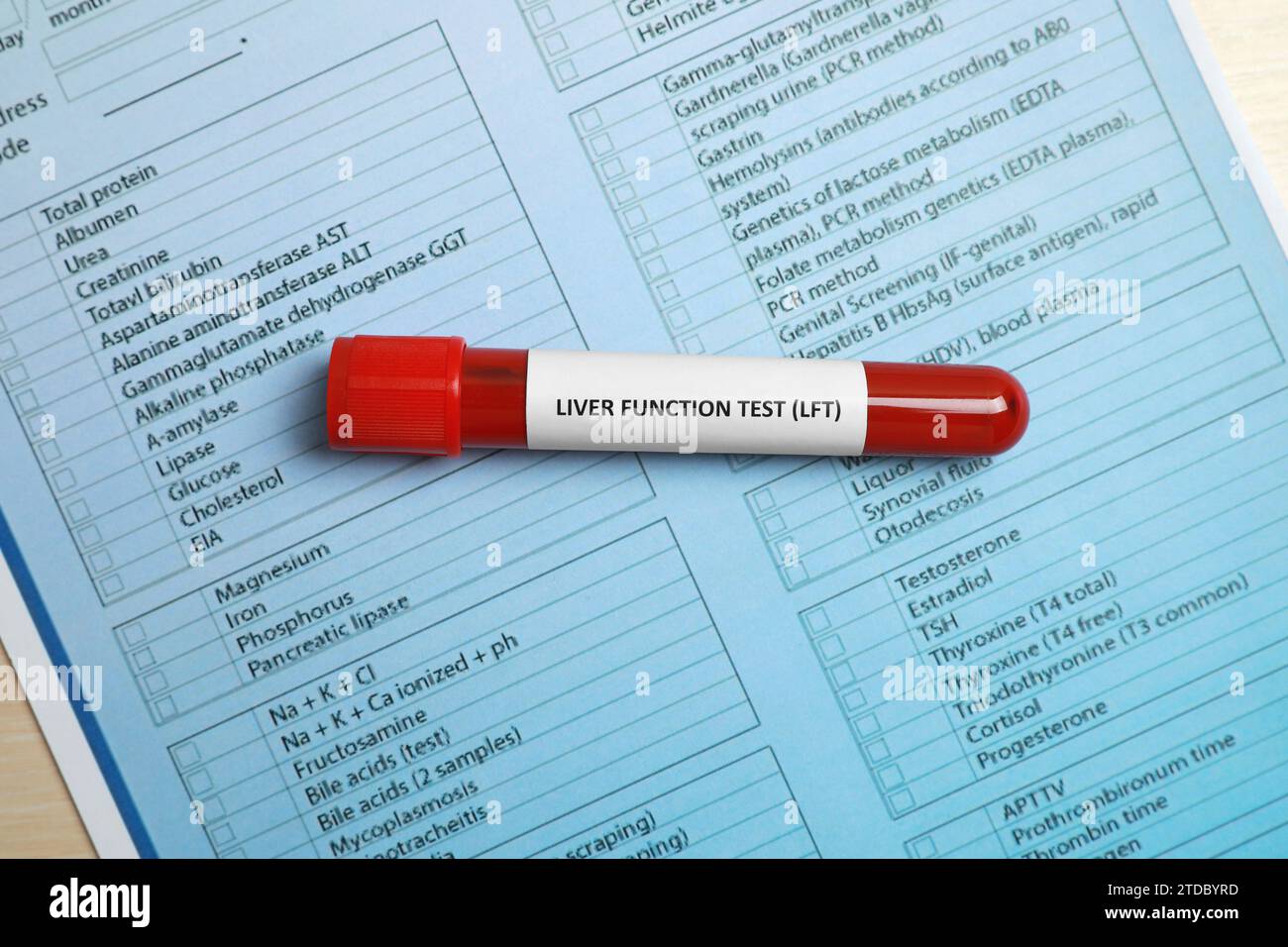 Liver Function Test. Tube with blood sample and laboratory form on ...