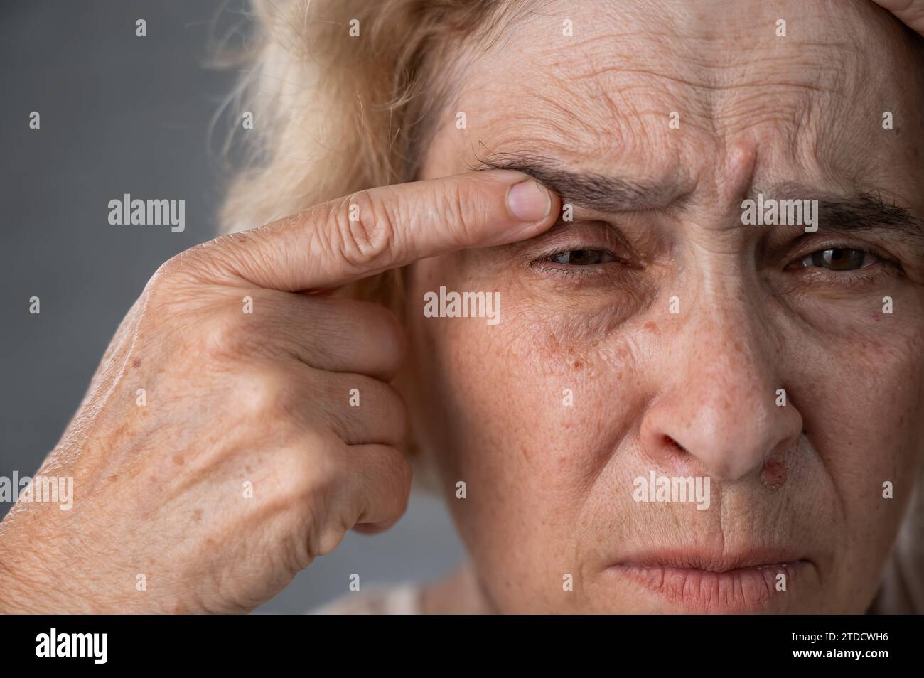 Close-up portrait of an old woman pointing at a wrinkle on her upper ...