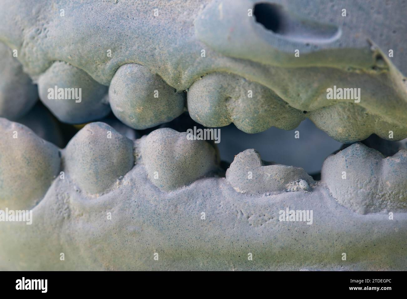 Blue plaster impression of the dental jaw of a patient with crooked ...