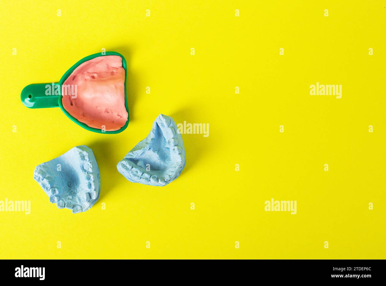 Blue plaster cast of a dental jaw and a dental tray for an impression ...