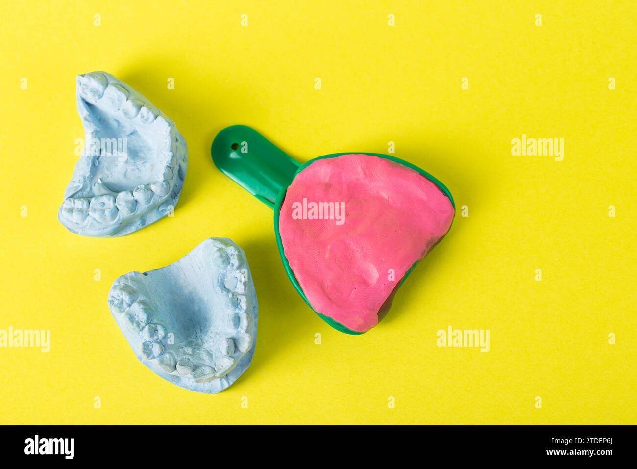 Dental spoon with alginate plastic mass for taking an impression of the ...