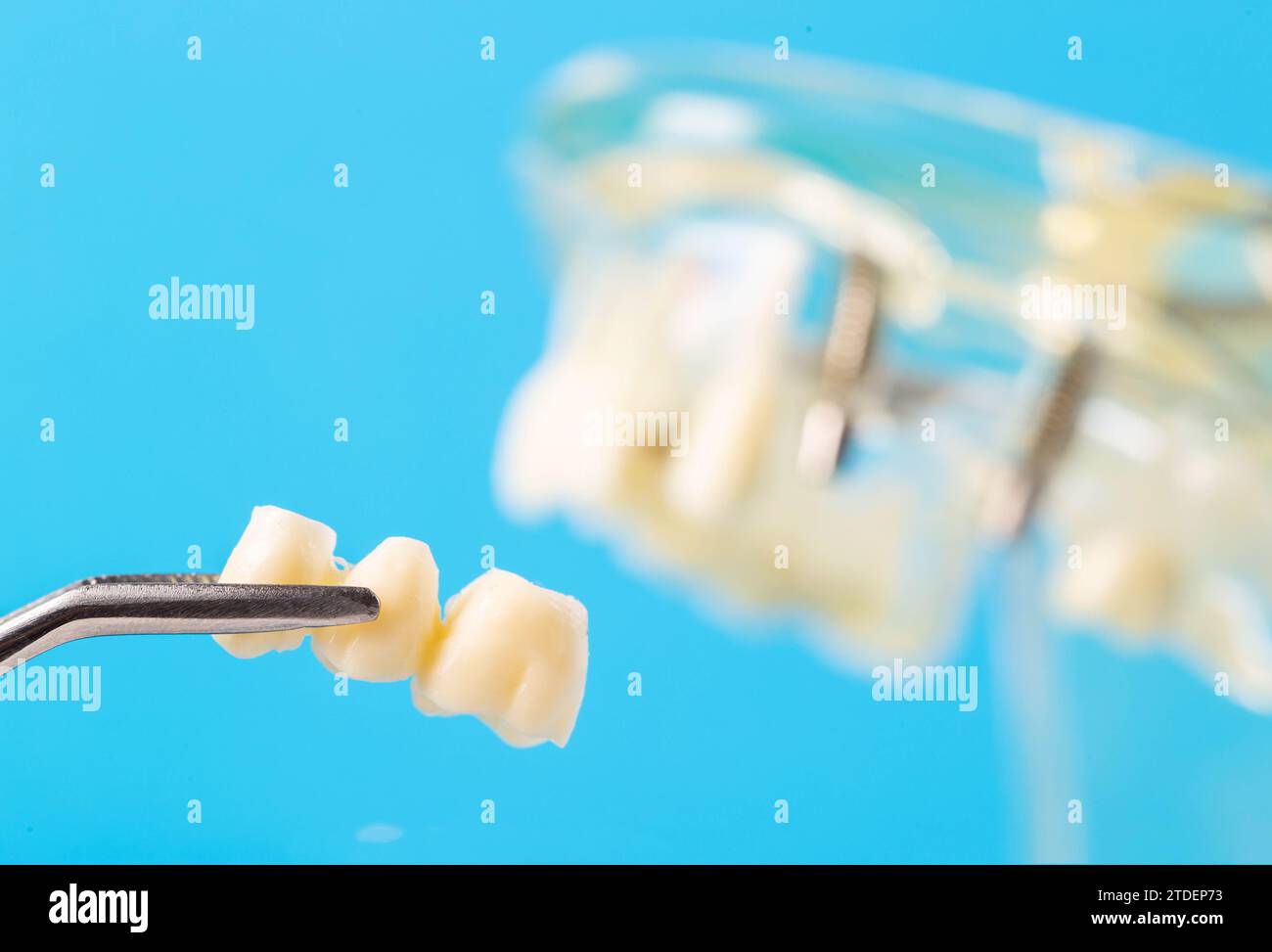 Dental bridge in tweezers hi-res stock photography and images - Alamy
