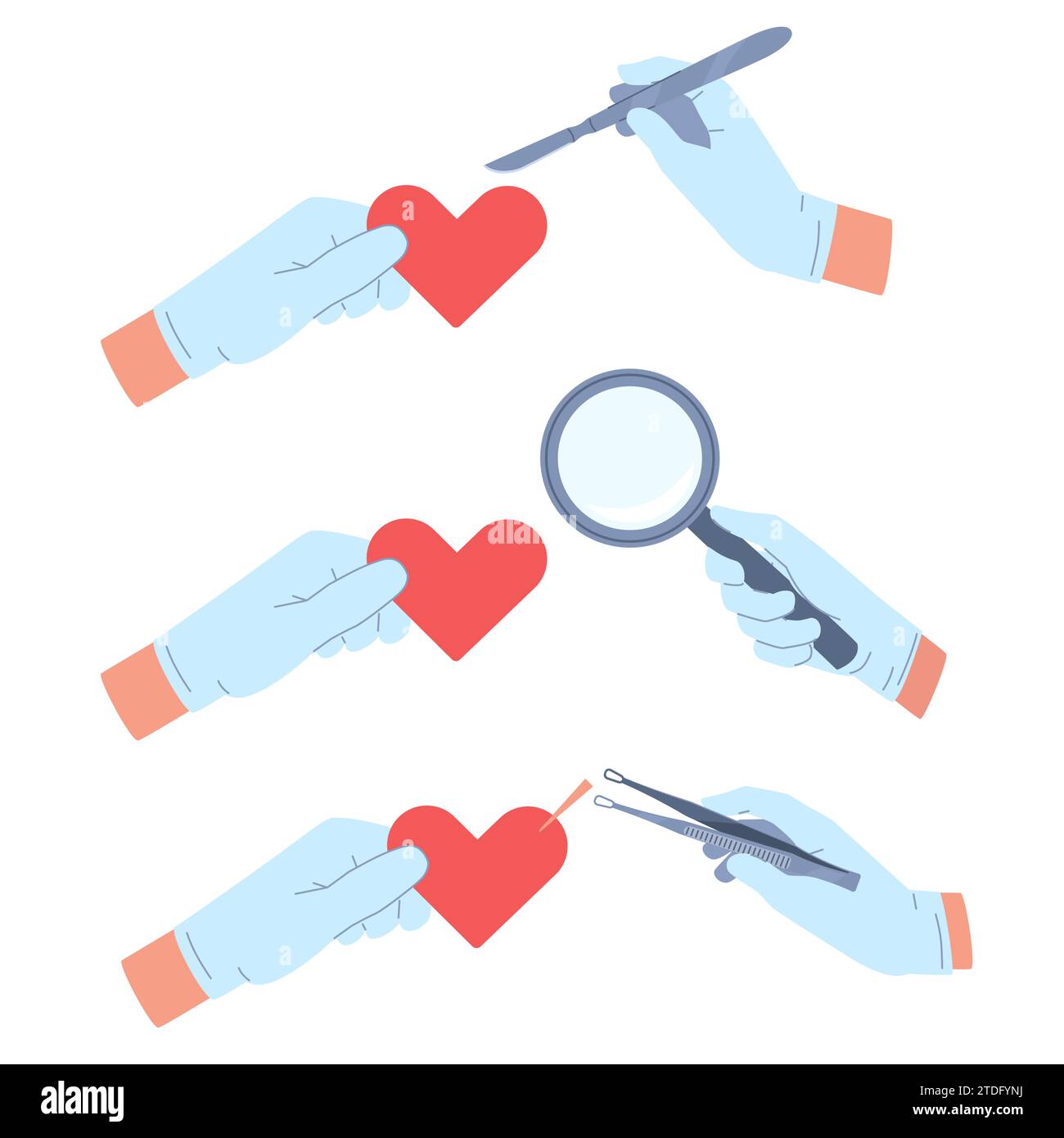 Concept of treating heart pain, gloved hands with scalpel, magnifying ...