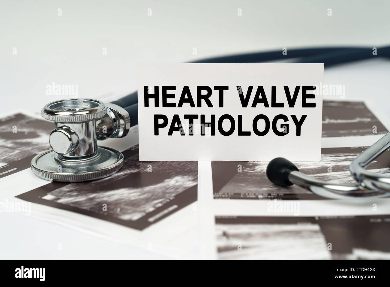 Medical concept. On the ultrasound pictures there is a stethoscope and ...