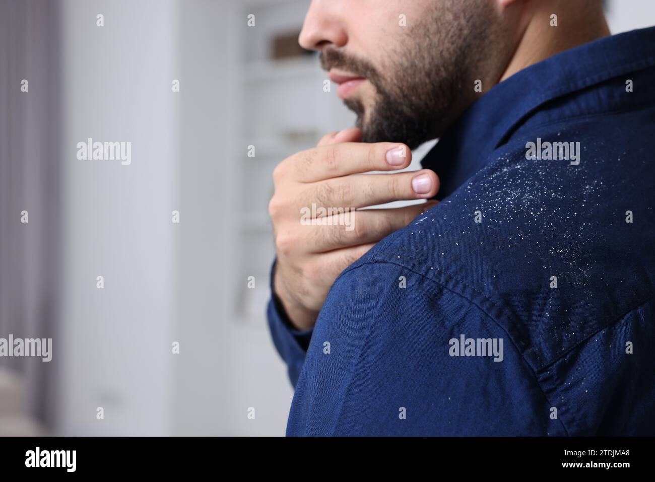 Man brushing dandruff off hi-res stock photography and images - Alamy