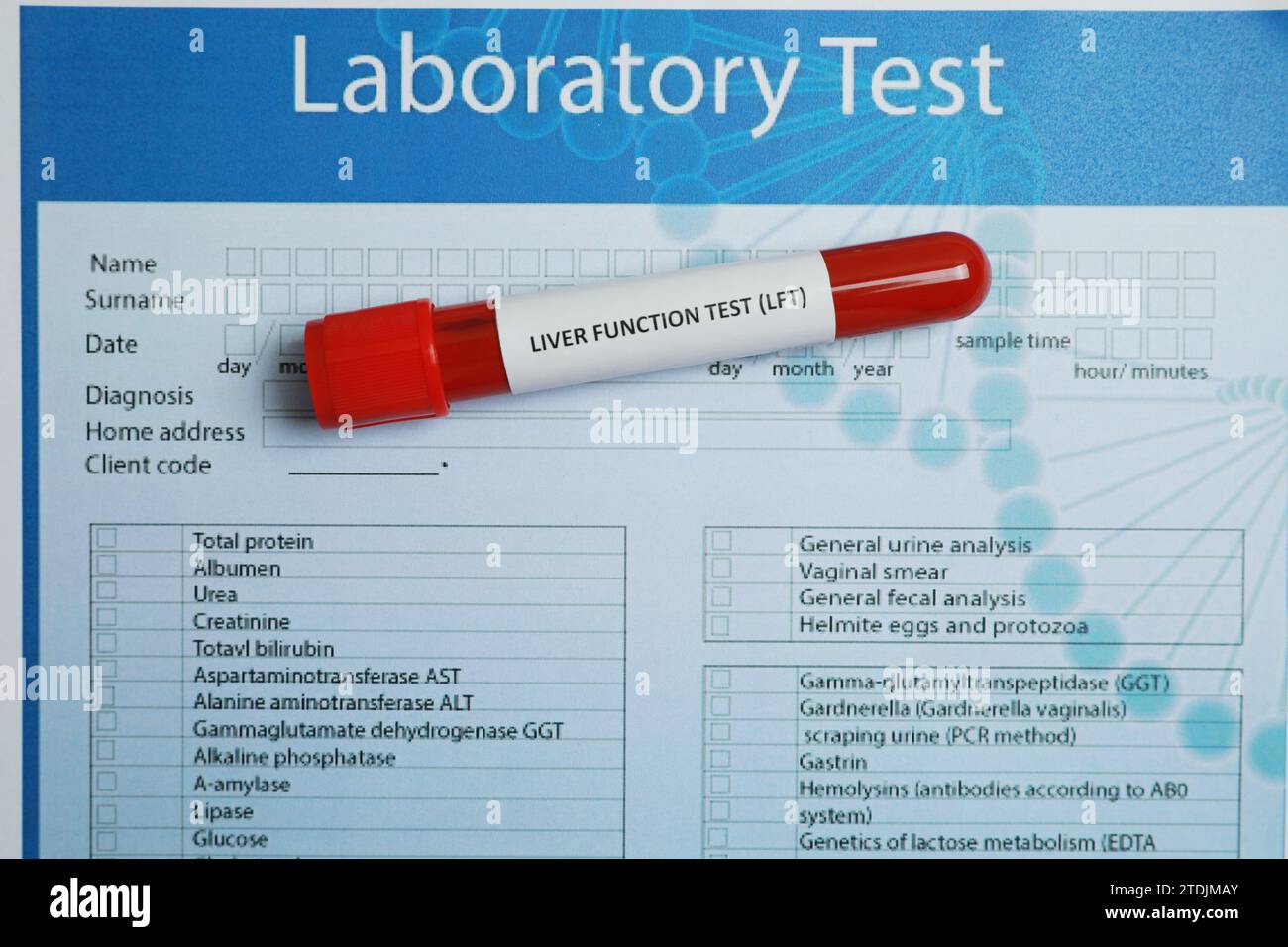 Liver Function Test. Tube with blood sample on laboratory form, top ...