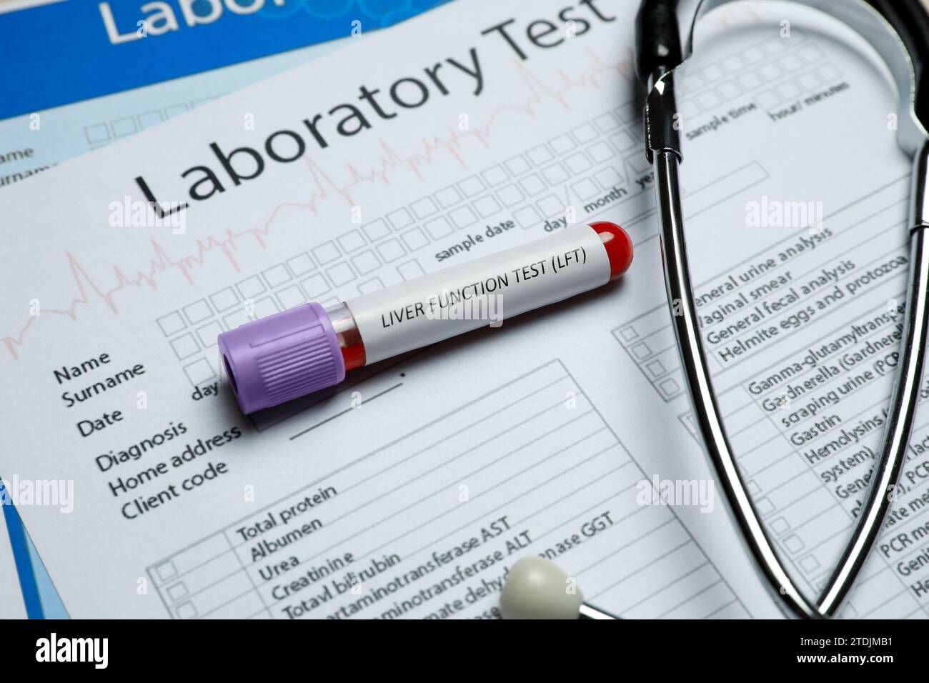 Liver Function Test. Tube with blood sample and stethoscope on ...