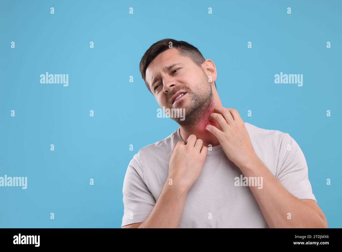 Allergy symptom. Man scratching his neck on light blue background ...