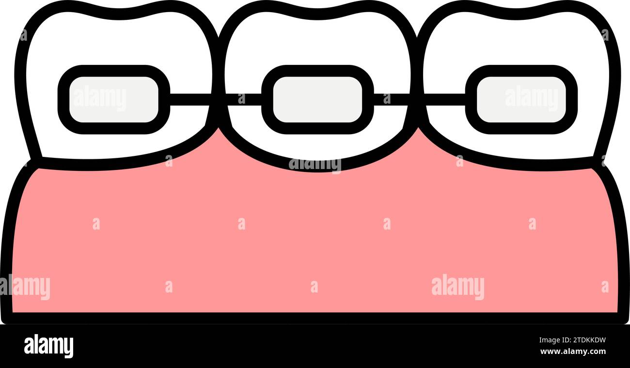 Dentistry: Orthodontic appliances and metal brackets used to straighten teeth, Vector ...