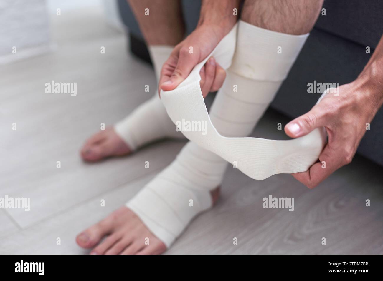 Stress fracture tibia hi-res stock photography and images - Alamy