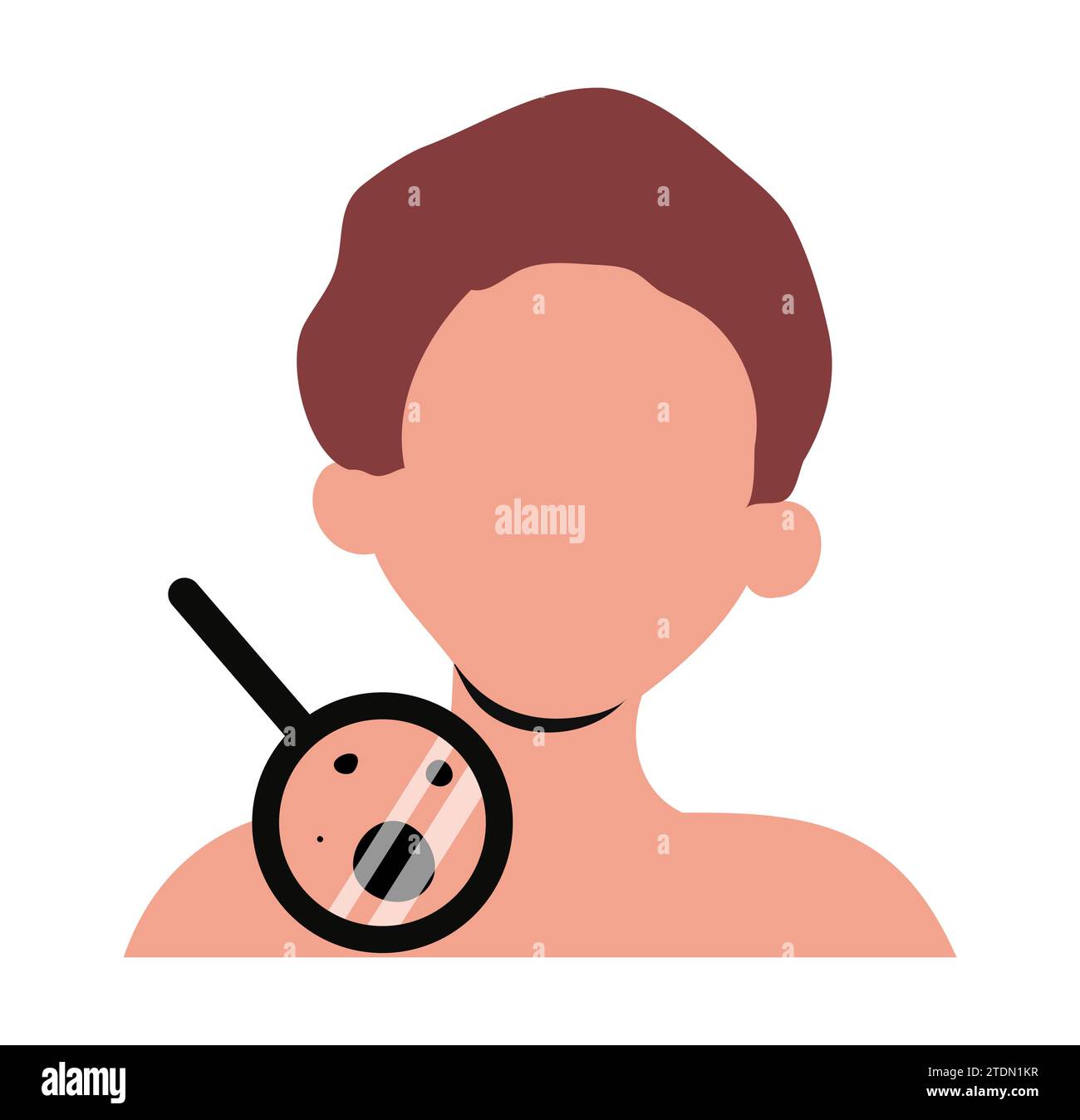 Melanoma diagnosis dermatology examination icon vector illustration Stock Vector Image & Art - Alamy