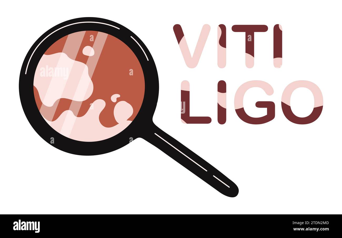 Vitiligo vector skin background Stock Vector Images - Alamy