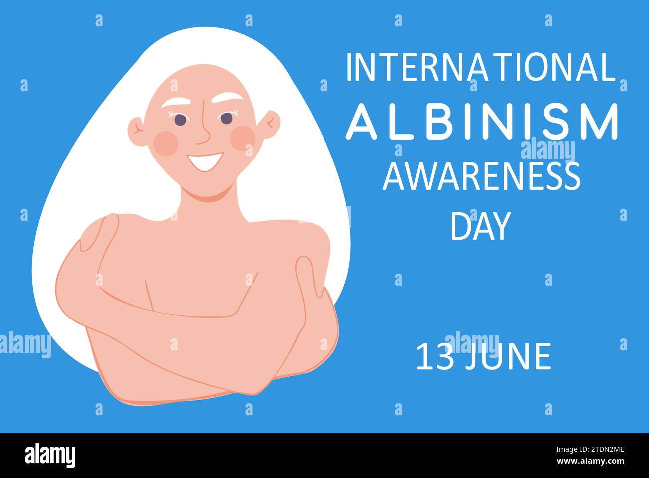 International Albinism awareness day albino vector illustration Stock ...