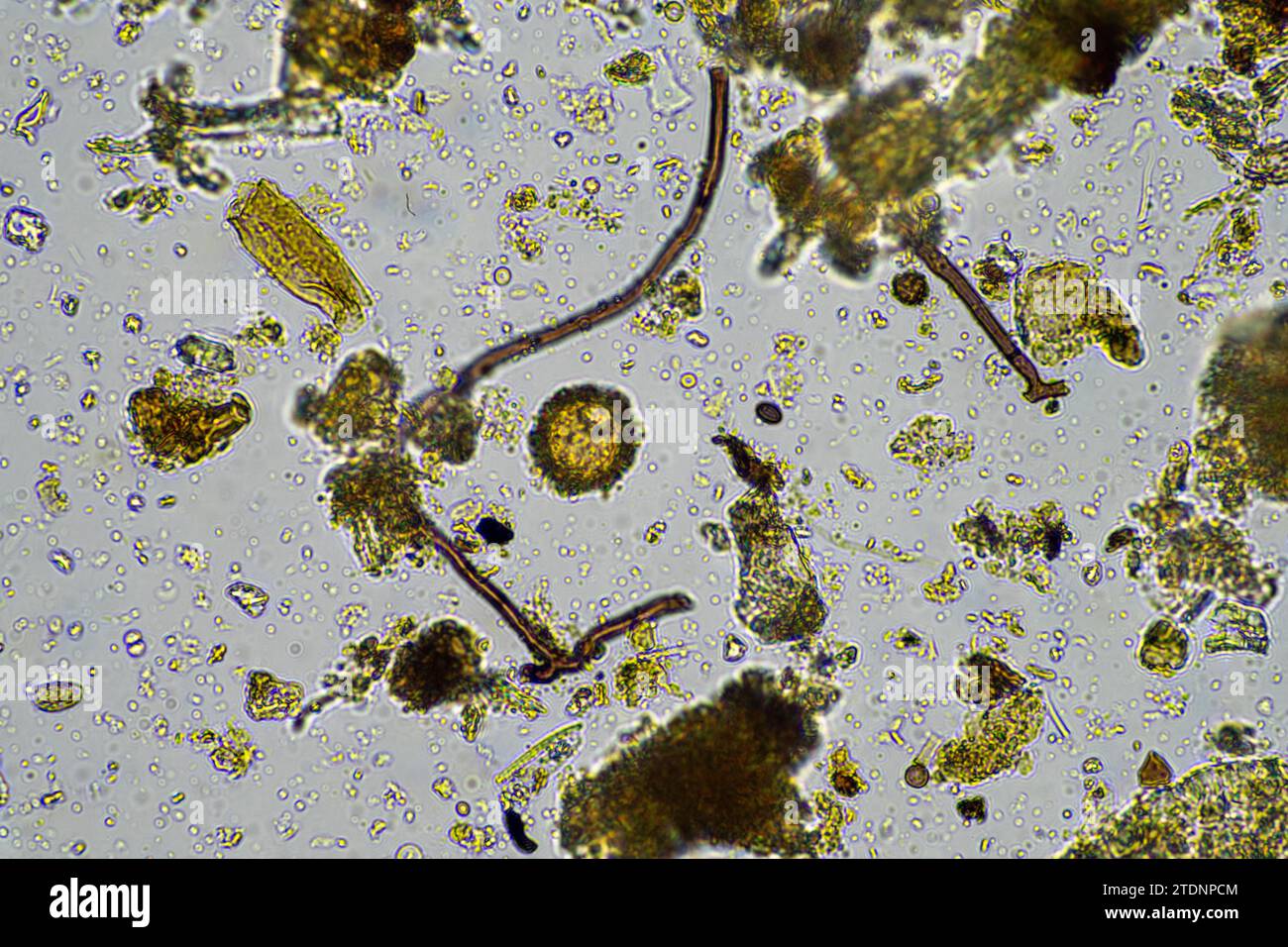 soil microorganism under the microscope recycling nutrients in a ...
