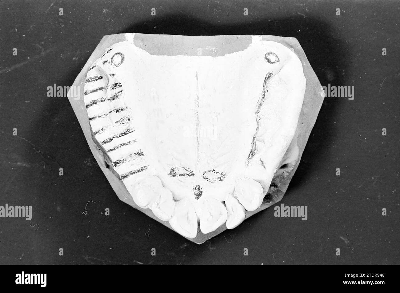 Photos of mouths and teeth and impressions of teeth, 05-03-1965 ...