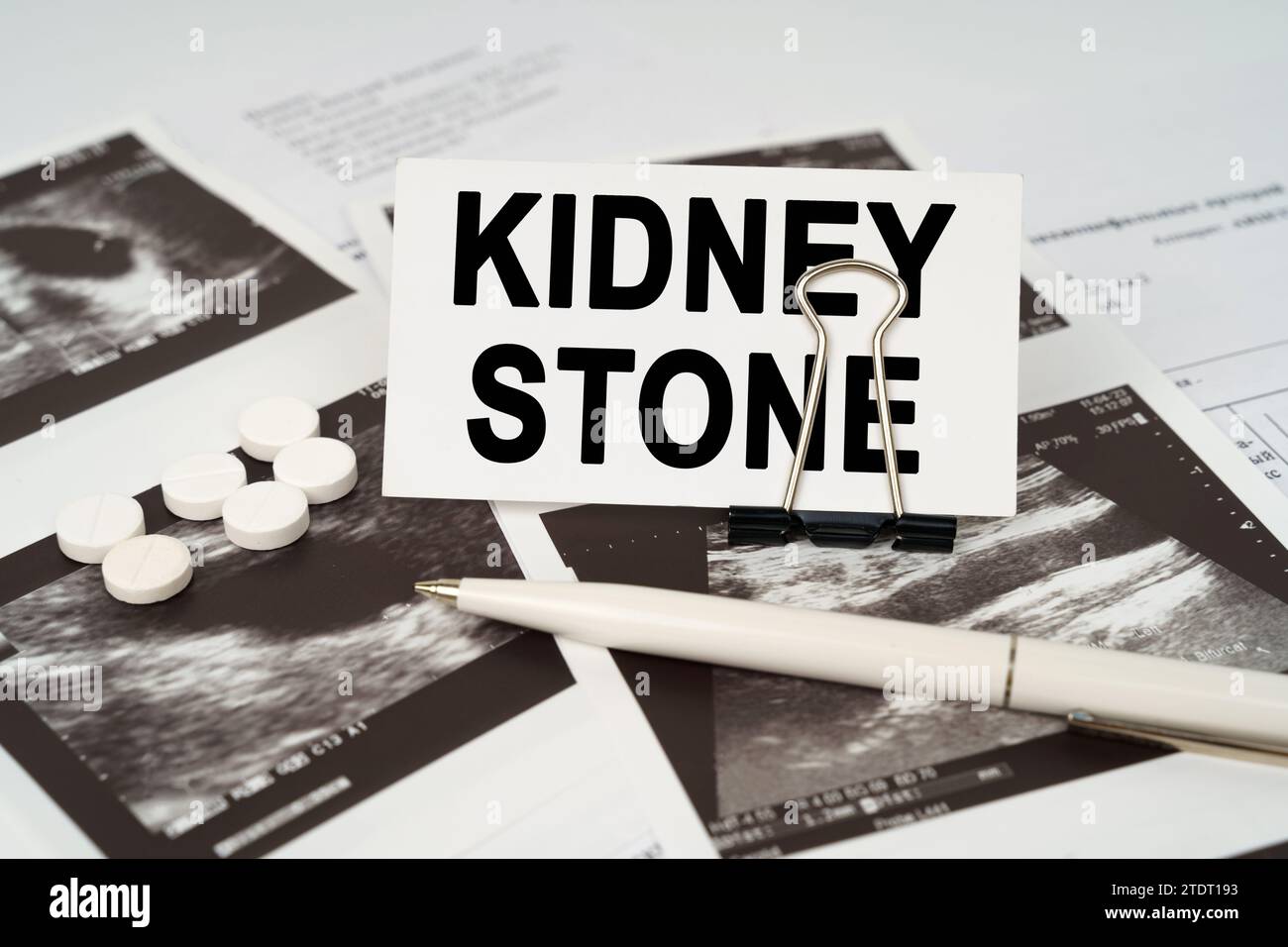 Medical concept. On the ultrasound pictures there is a pen and a ...