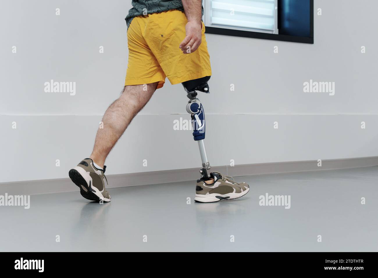 Unrecognisable male in yellow coloured shorts wearing prosthetic leg ...