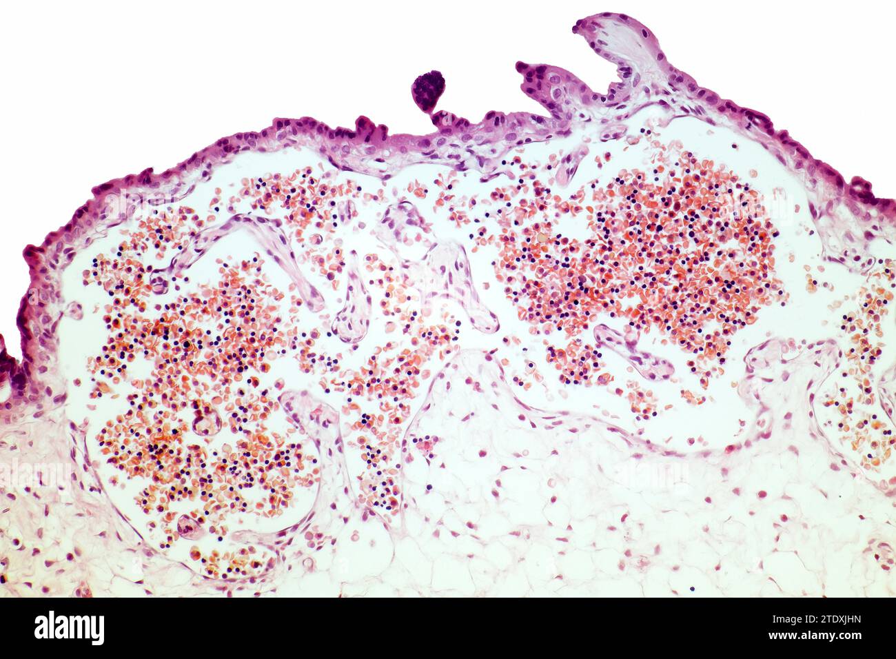 Nucleated red blood cells in placental blood vessels. Light micrograph ...