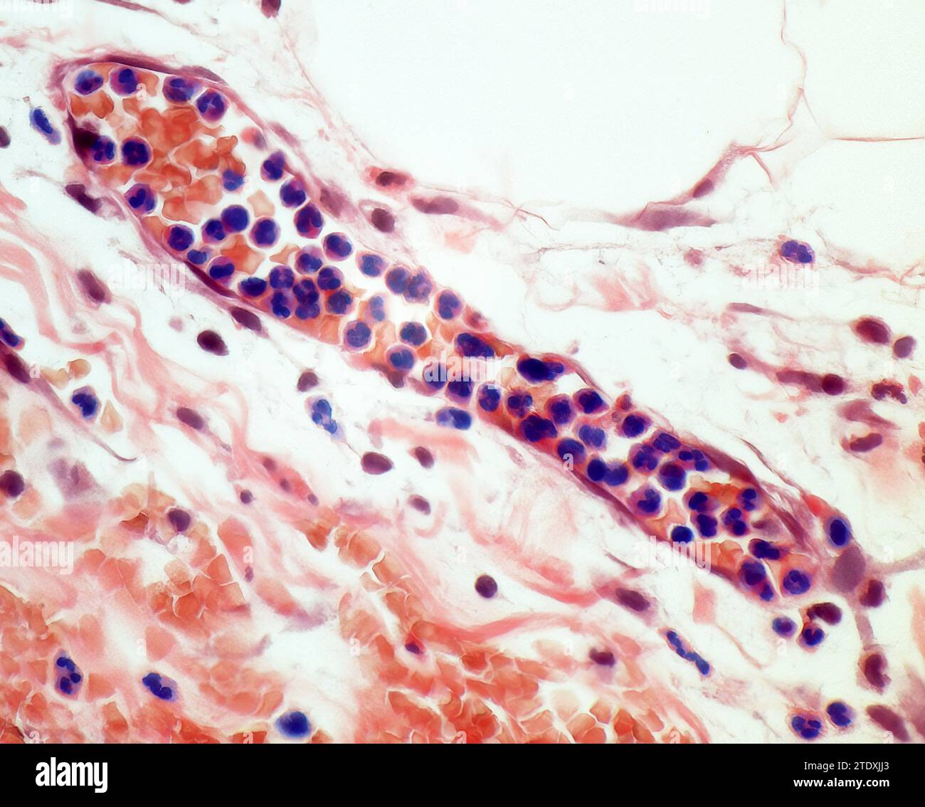 Inflammatory response. Light micrograph of a section through a venule ...