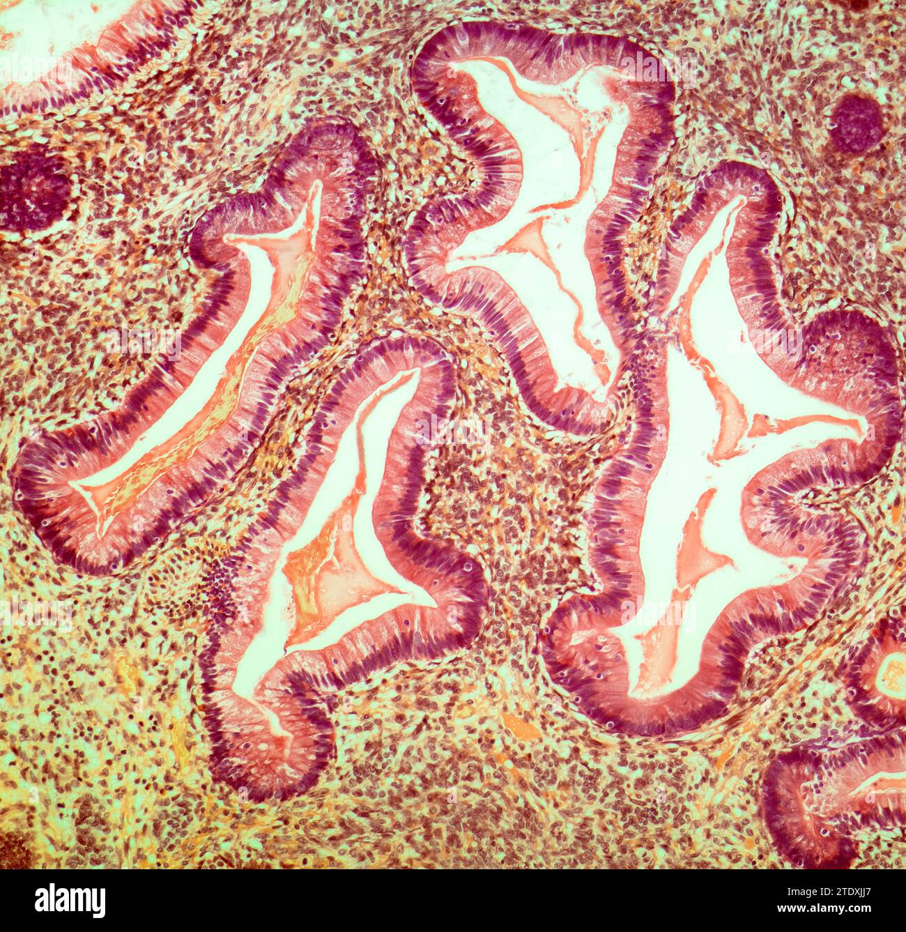 Uterine lining. Light micrograph of a section through human uterine ...
