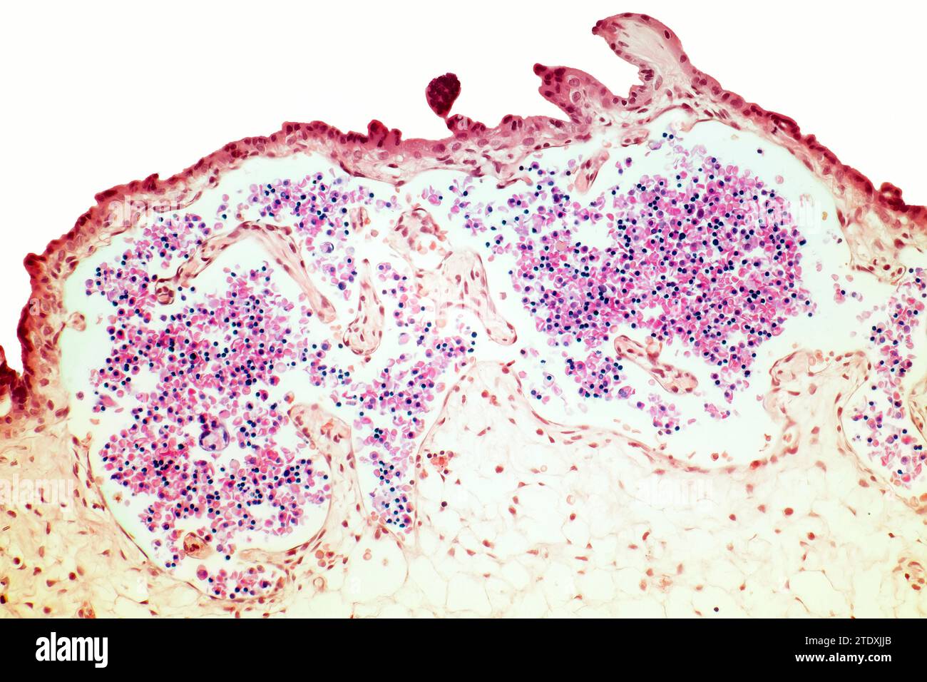 Nucleated red blood cells in placental blood vessels. Light micrograph ...