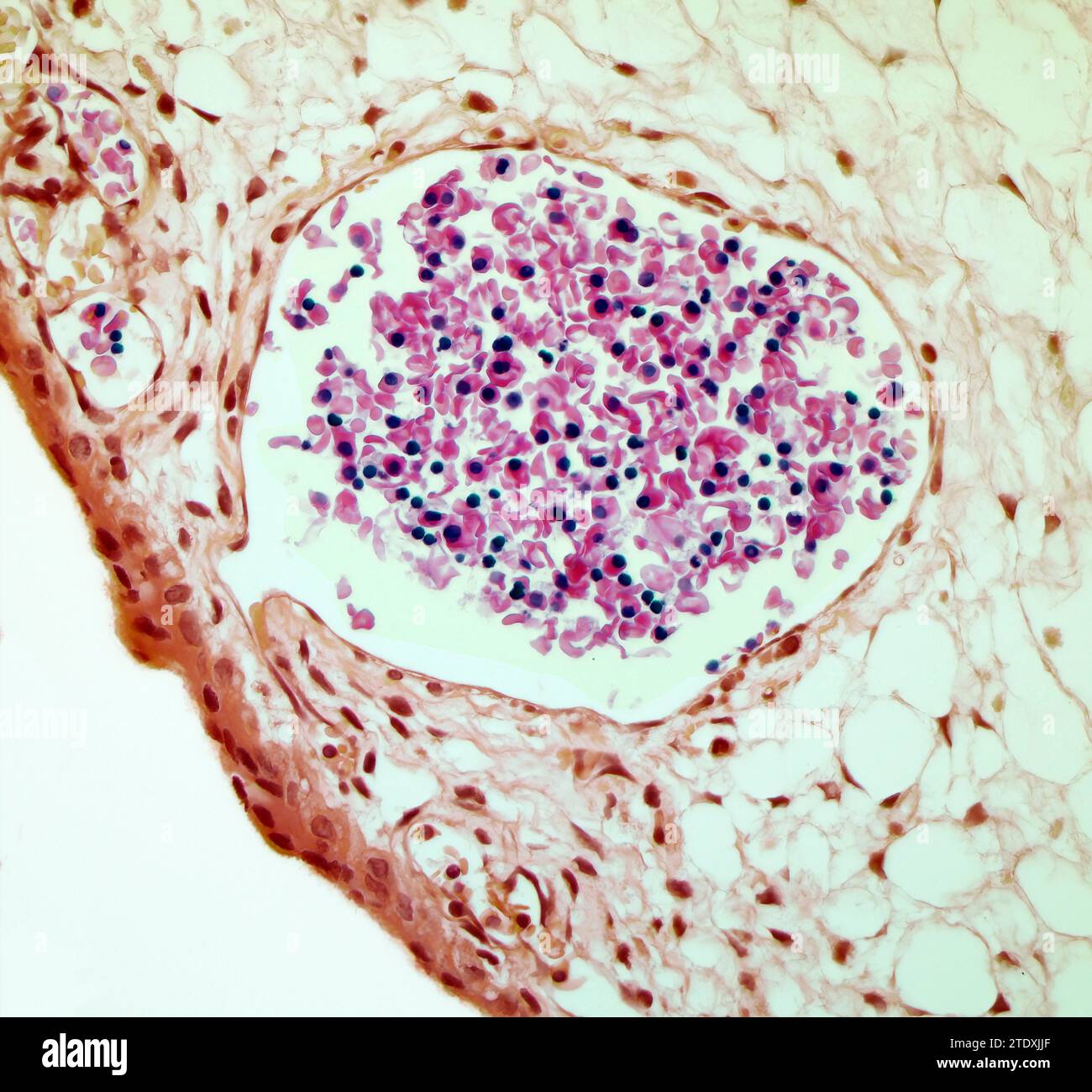 Nucleated red blood cells in placental blood vessels. Light micrograph ...