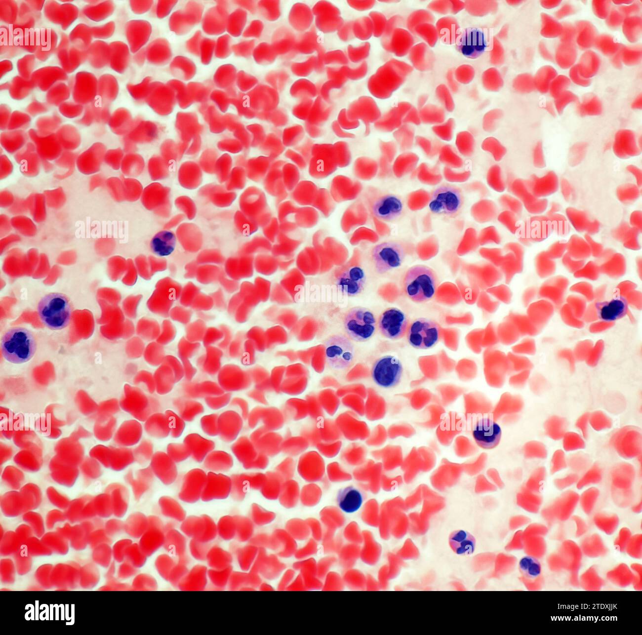 Inflammatory response. Light micrograph of a section through a vein ...