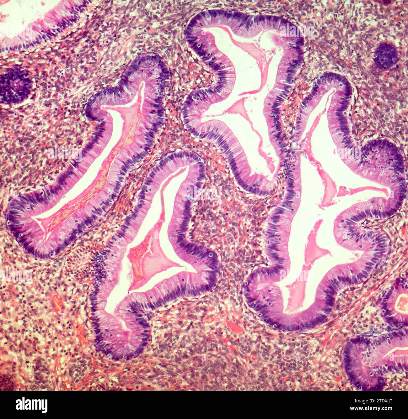 Uterine lining. Light micrograph of a section through human uterine ...