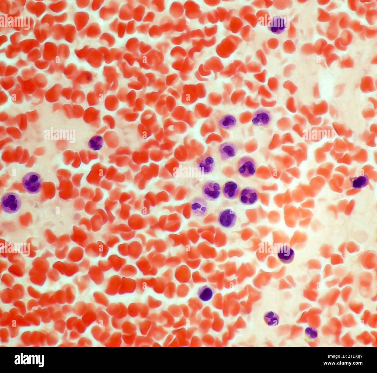Inflammatory response. Light micrograph of a section through a vein ...