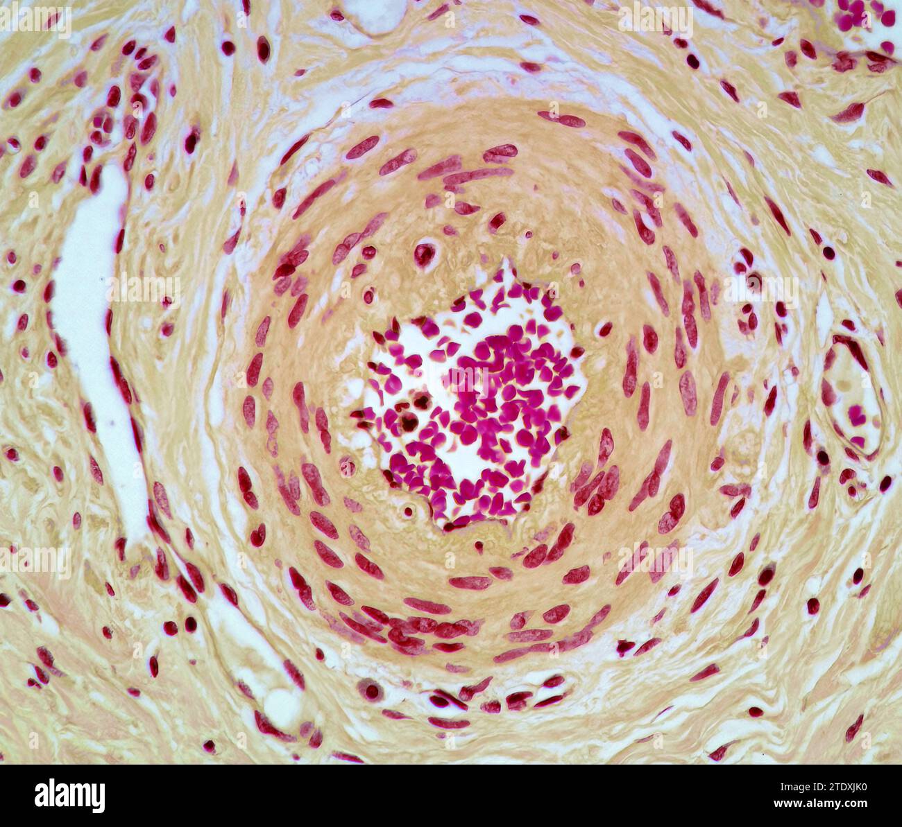 Arteriole. Light micrograph of a section through an arteriole, a small ...