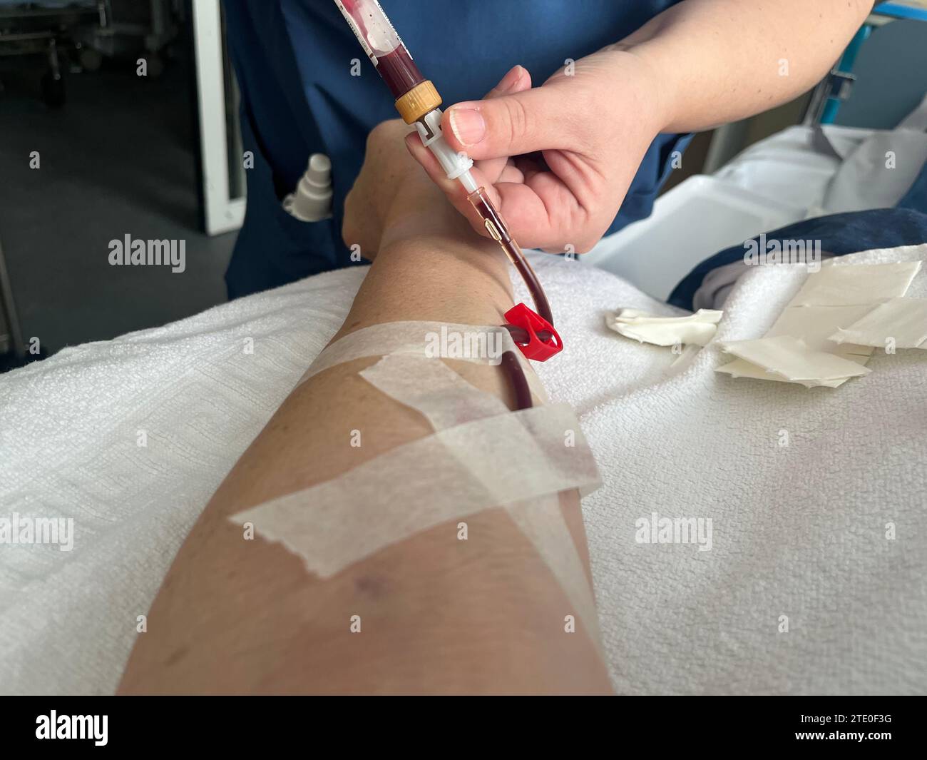 Venous blood collection hi-res stock photography and images - Alamy