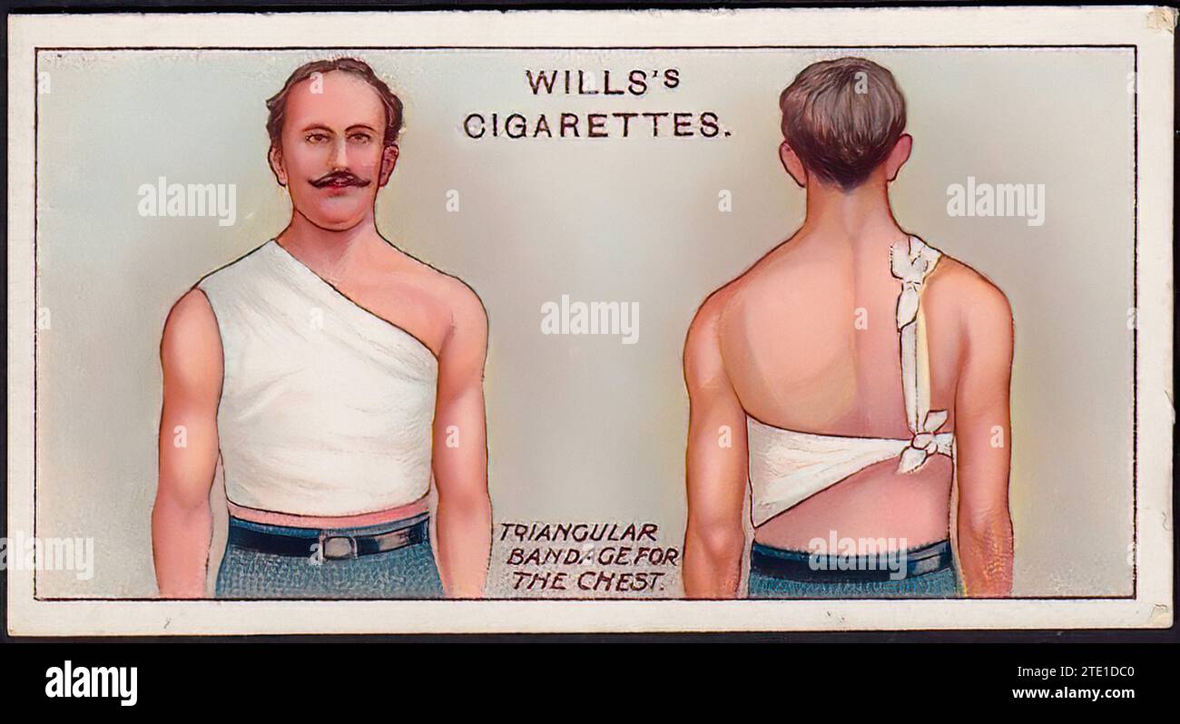 Chest Bandage - Vintage Cigarette Card Illustration Stock Photo - Alamy