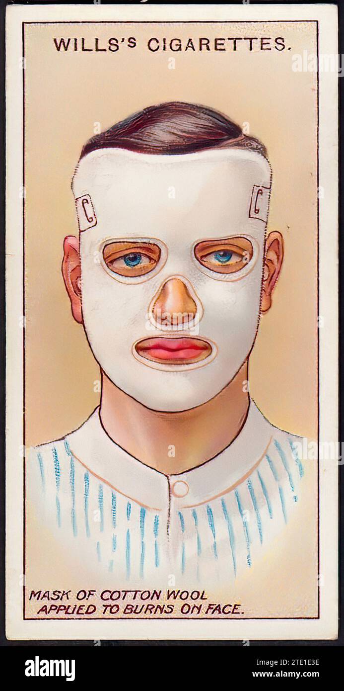 Face Mask For Burns - Vintage Cigarette Card Illustration Stock Photo ...